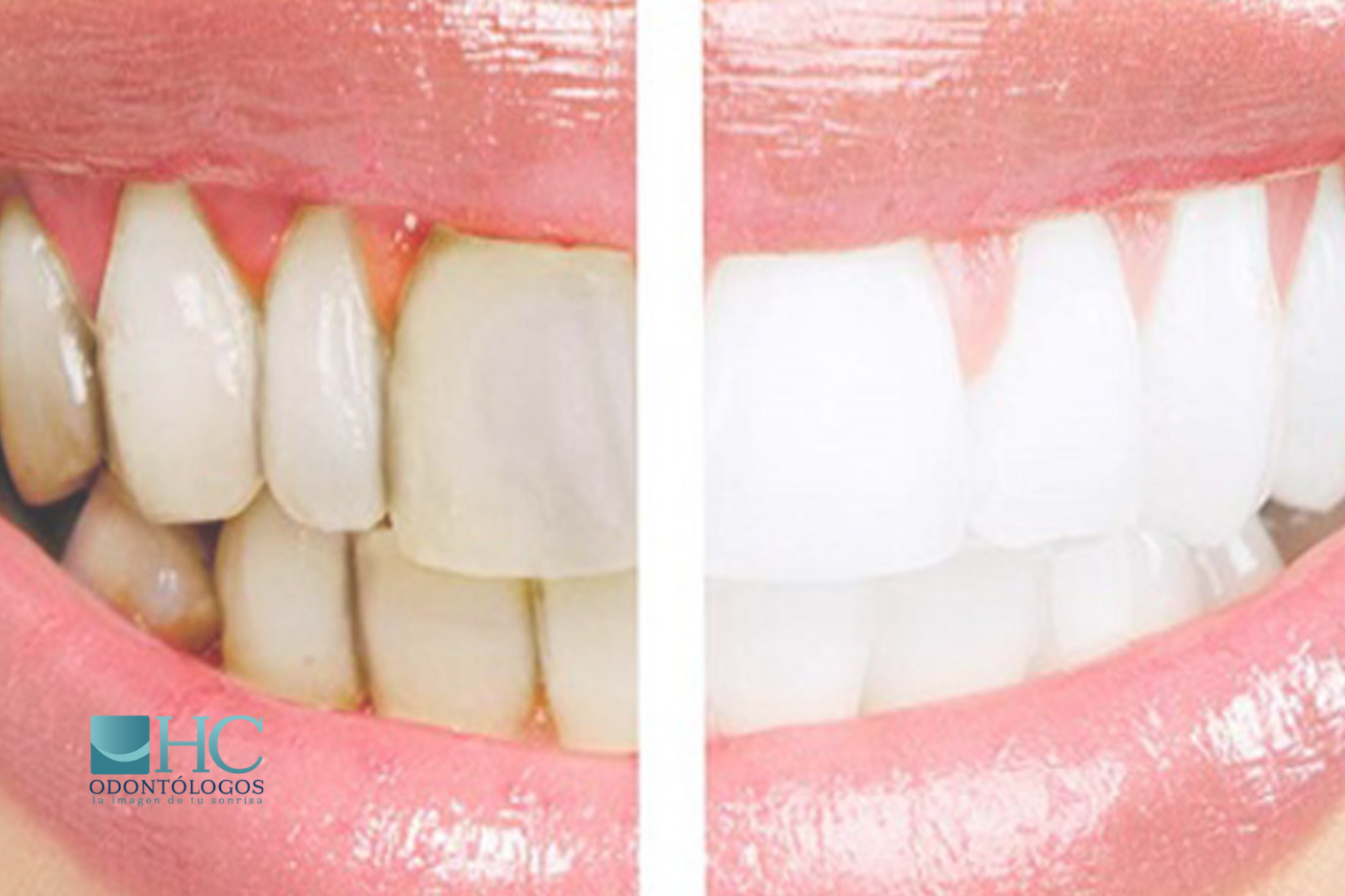 ¿Cómo saber si mi boca está sana? - 🦷 HC Odontólogos | Clínica Dental ...